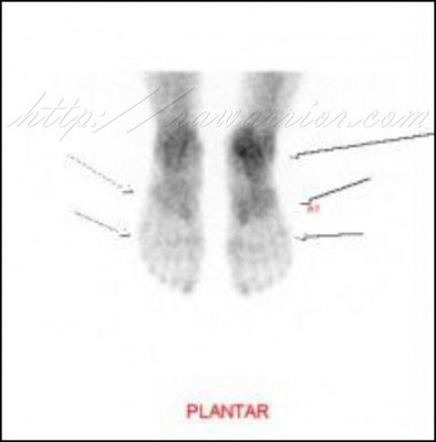 New Reading of the Nuclear Bone Scan: Credibility is Everything ...
