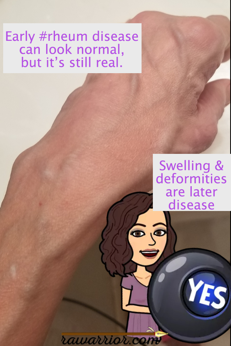 Early RA Diagnosis: Renovate the #rheum | Rheumatoid Arthritis Warrior